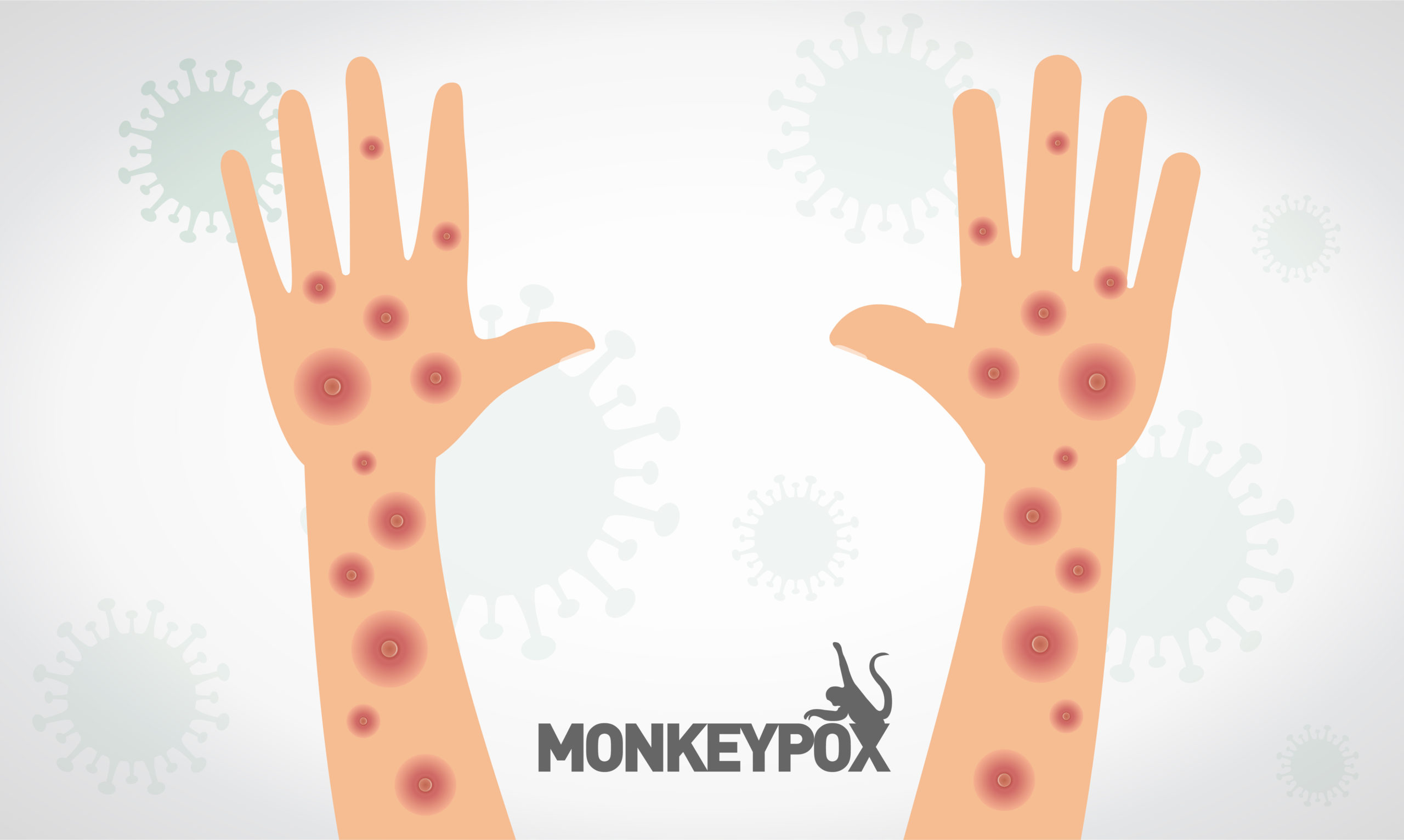 The Latest Monkeypox Updates | PeopleHype
